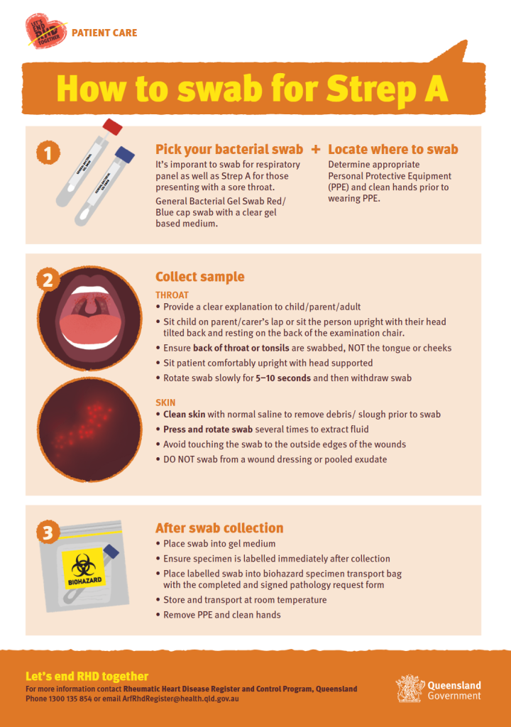 How to swab for Strep A - RHD Menzies